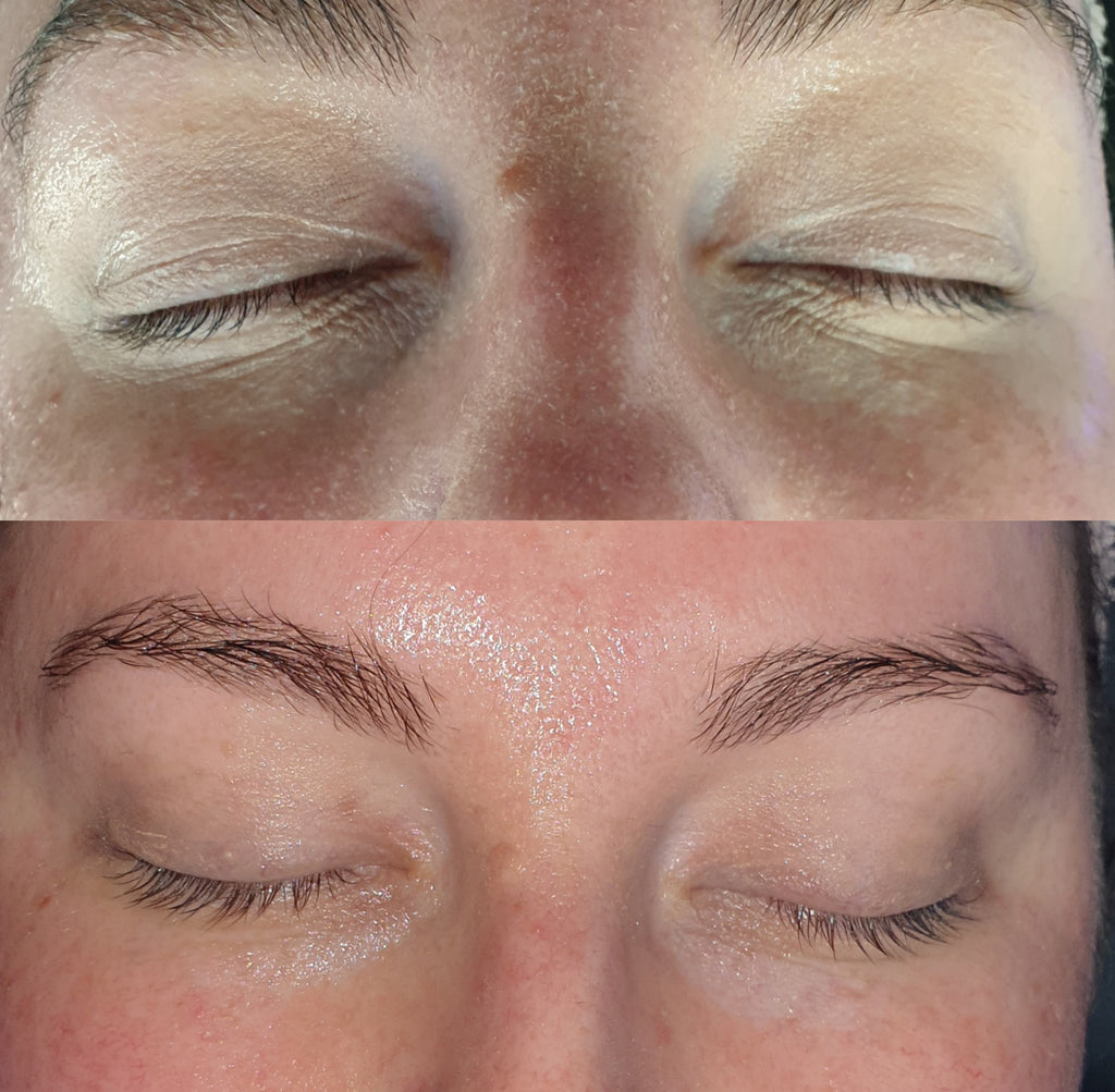 Brisbane's Best Facial - Dermal Infusion – Revamp Aesthetics